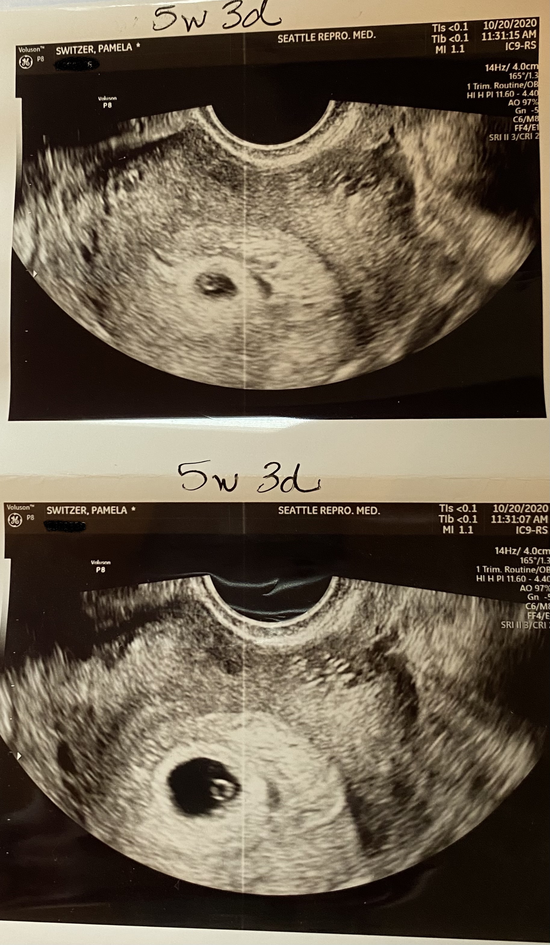 10/20/2020: 5w3d Something IS different: first ultrasounds. – Switzer Twins